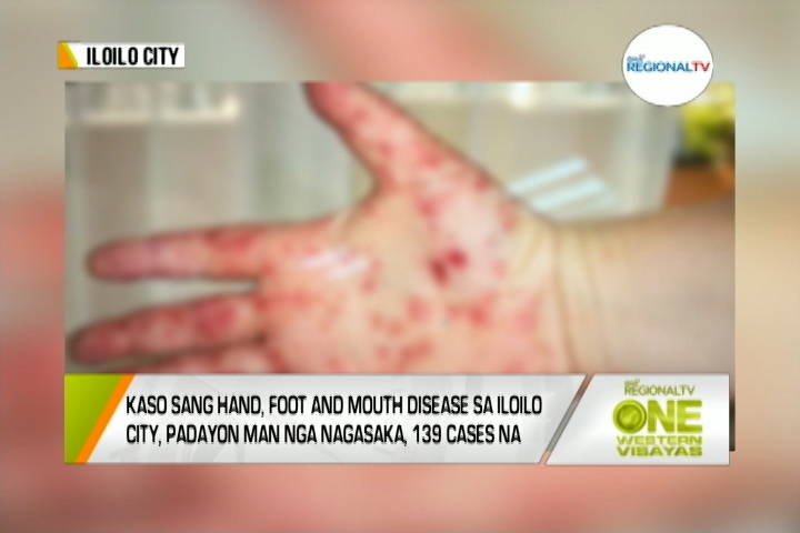 One Western Visayas: Kaso sang Hand, Foot and Mouth Disease sa Iloilo City, Padayon man nga Nagasaka