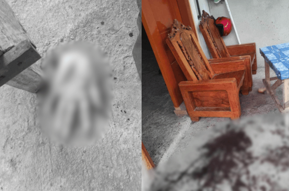 Son hacks off mother’s hand in Pangasinan