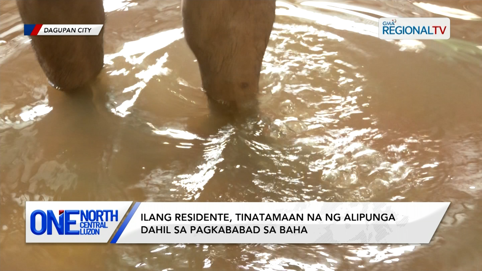Ilang residente, tinatamaan na ng alipunga dahil sa pagkababad sa baha ...