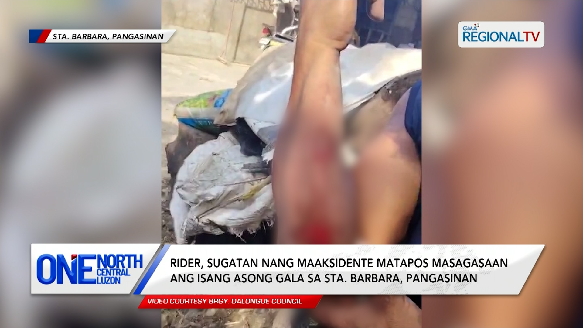 Rider, sugatan nang maaksidente matapos masagasaan ang isang asong gala ...