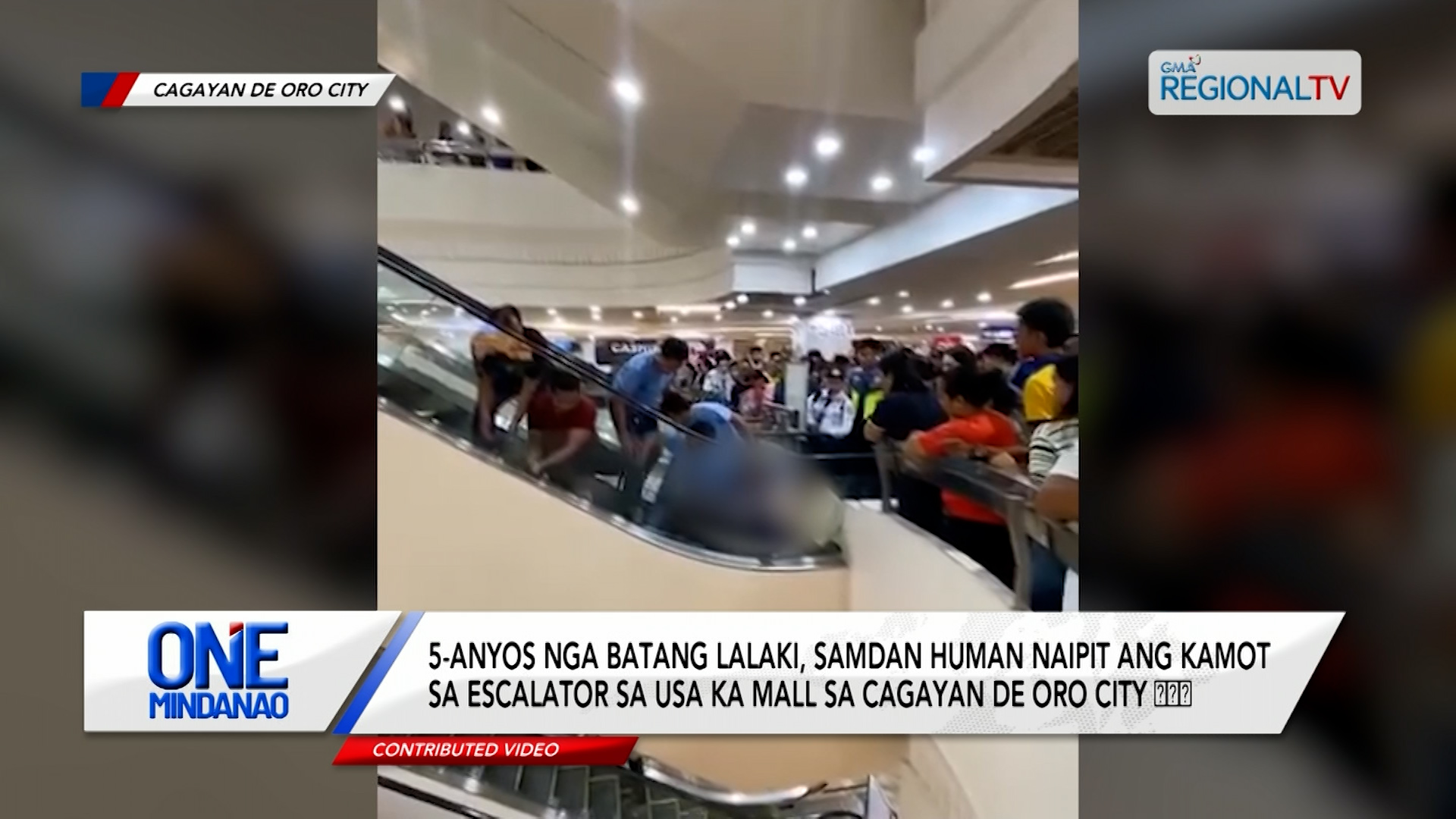 5-anyos nga batang lalaki, samdan human naipit ang kamot sa escalator I ...