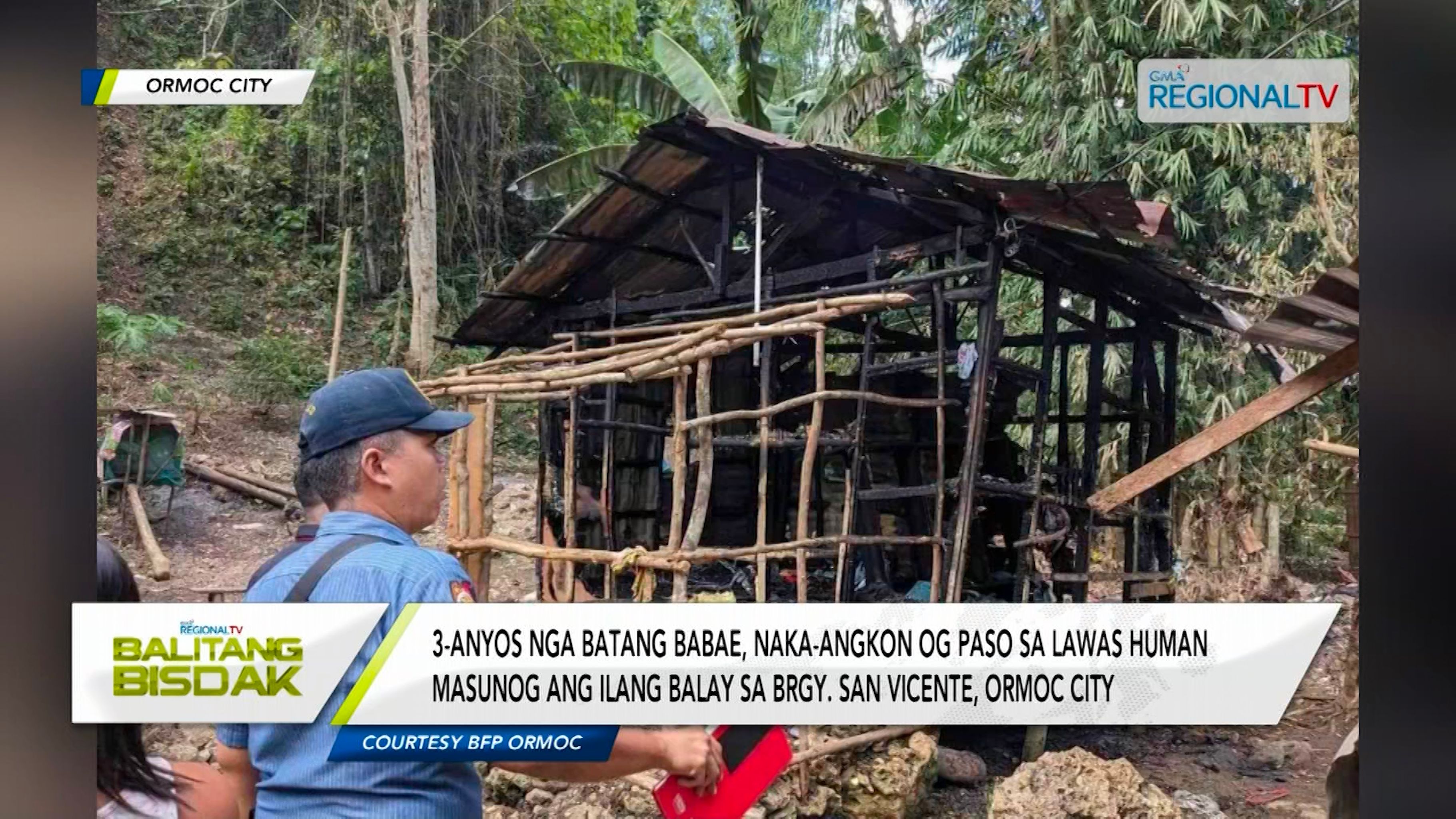 3-anyos nga bata, napaso sa sunog sa Ormoc City
