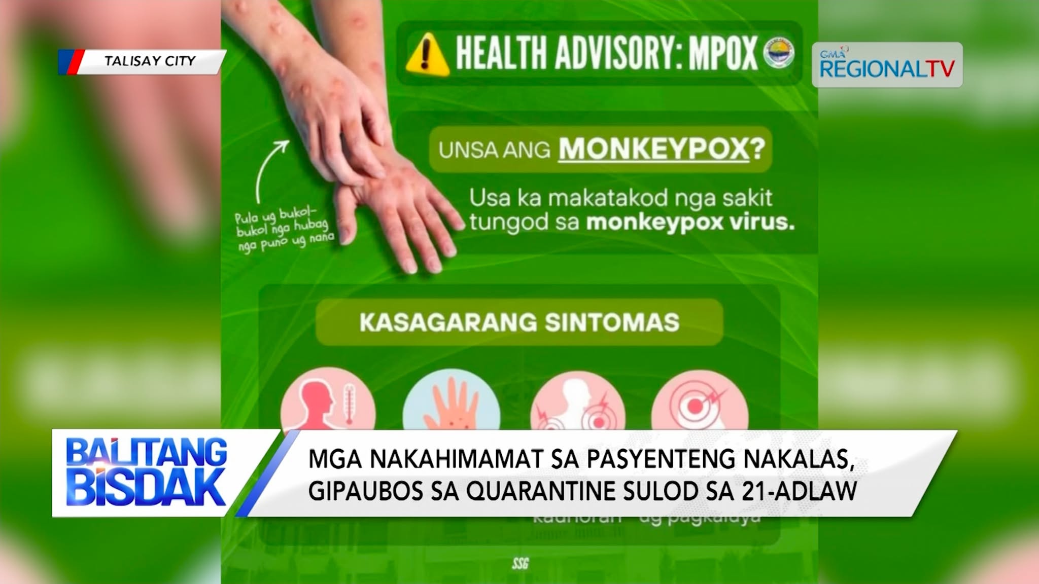 Labing unang kaso sa monkeypox sa Talisay City, gikompirmar sa LGU