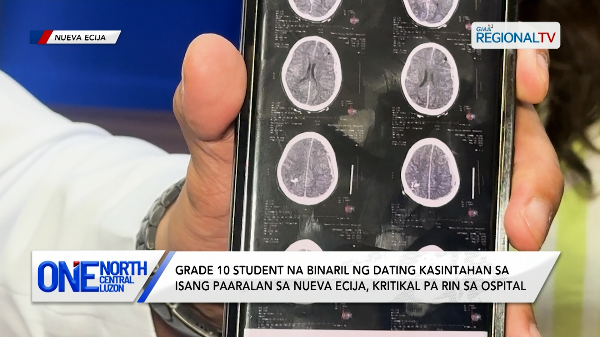 Grade 10 student na binaril ng dating kasintahan, kritikal pa rin | One North Central Luzon