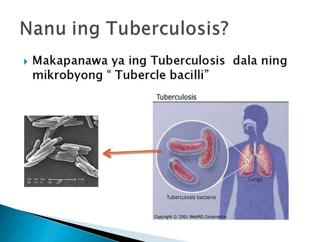 Indigenizing TB control among the Aeta | GMA News Online