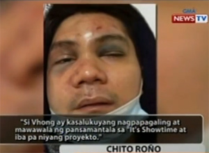 Nbi Nabs Suspect In Vhong Navarro Mauling Vhong Navarro Navarro