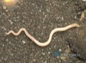 Bata, namatay dahil sa komplikasyon dulot ng sobrang dami ng bulate sa ...