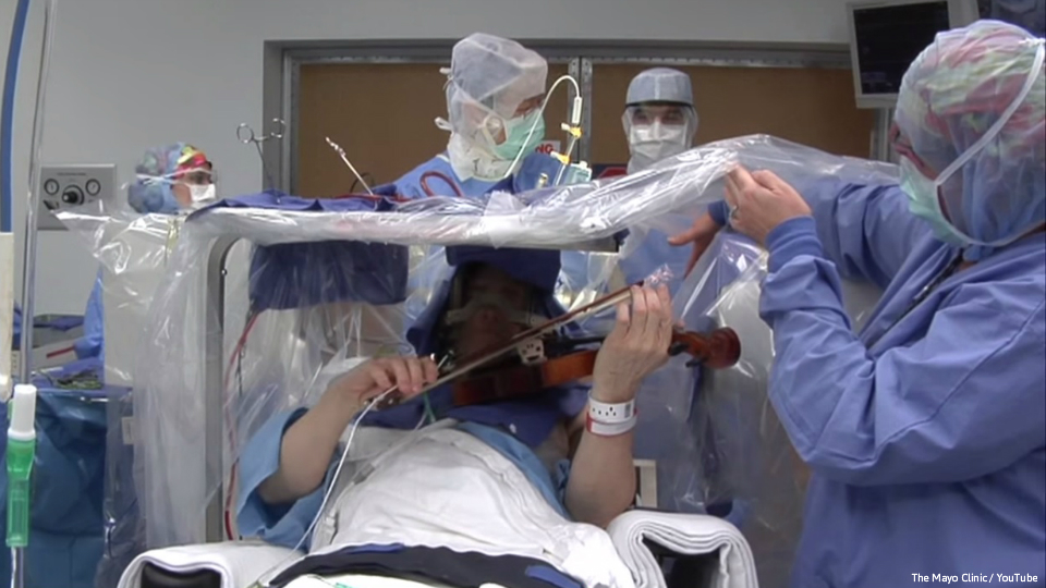 WATCH: Violinist performs during his own brain surgery | GMA News Online