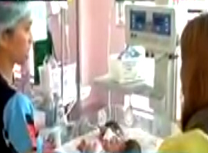 Conjoined twins sa Naga City, pumanaw na | GMA News Online