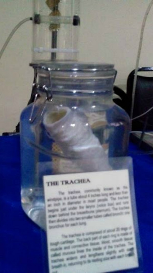 3D-printed organs, the future of transplants | GMA News Online