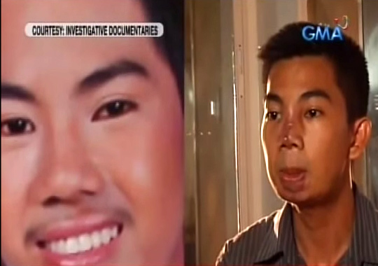 WATCH: Artistahing mukha ng isang lalaki, nasira dahil sa palpak na retoke | GMA News Online