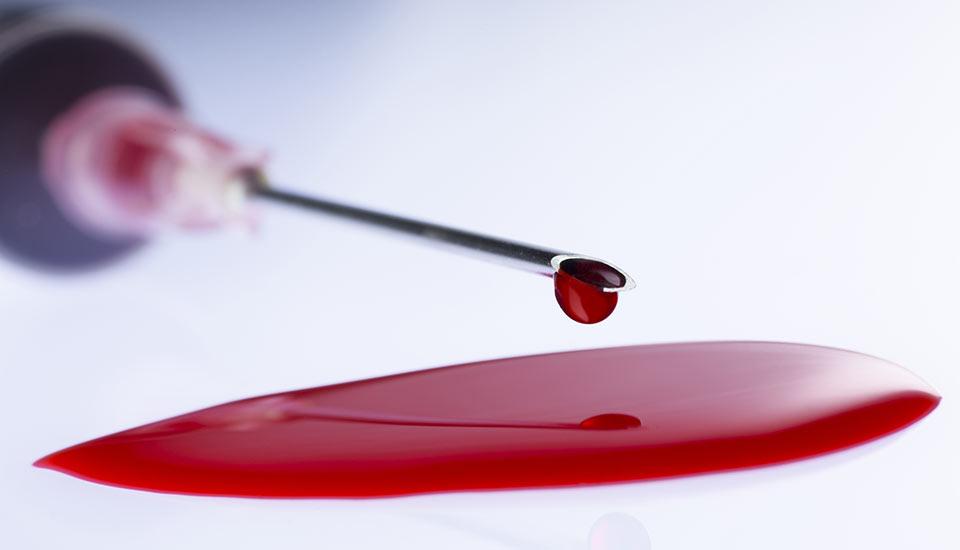 HK scientists say new research points to ‘functional cure’ for HIV ...