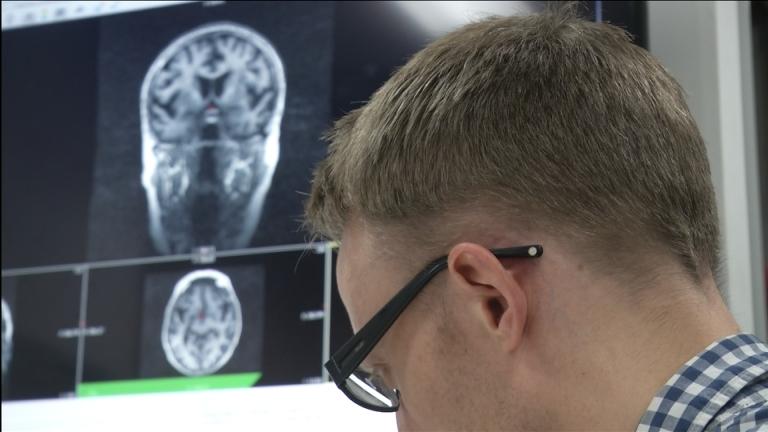 Neuroscientists can now predict 'brain age' | GMA News Online