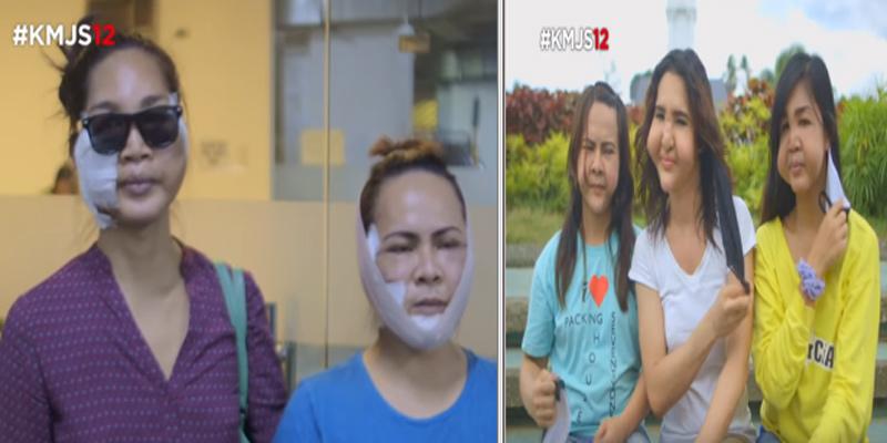 Magkakaibigang nasira ang mukha dahil sa palpak na retoke, nabigyan ng pag-asa | Balitambayan