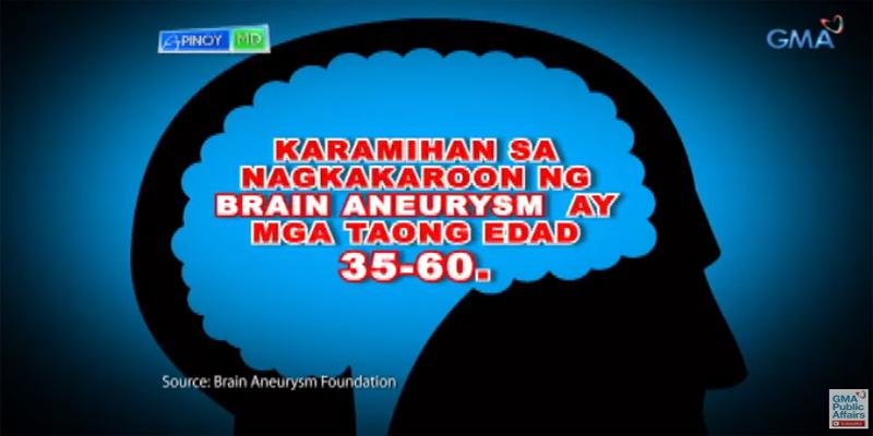 Ano ang aneurysm at papaano ito maiiwasan? | Balitambayan