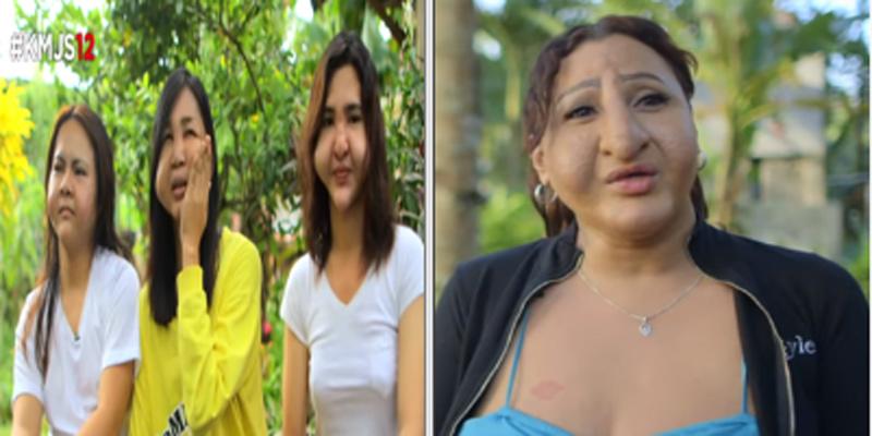 Ang paglantad ng isa pang beki na nasira ang mukha't katawan dahil sa hangaring gumanda ...