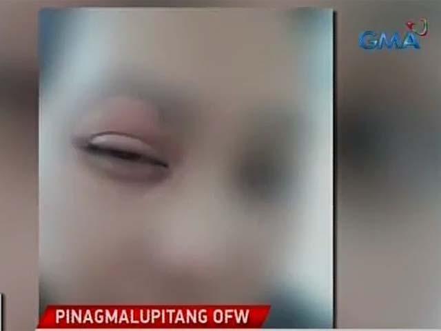 OFW na sinasaktan umano ng amo sa Kuwait, sinagip ng OWWA | Balitambayan