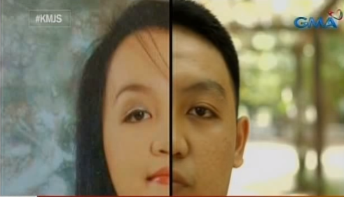 He was born a female and naturally transformed into a male | GMA News ...