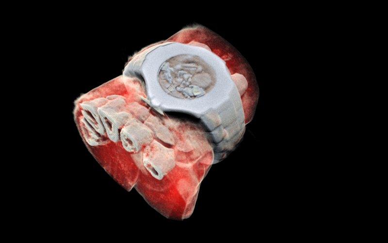 NZ scientists produce first 3D color X-ray on a human | GMA News Online