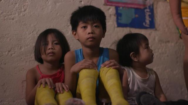 Tatlong magkakapatid na may clubfoot, tampok sa 'Front Row' | GMA News ...