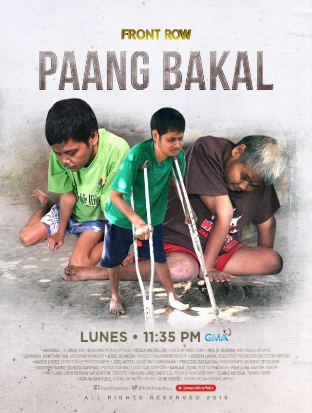 Tatlong magkakapatid na may polio, tampok sa ‘Front Row’ | GMA News Online