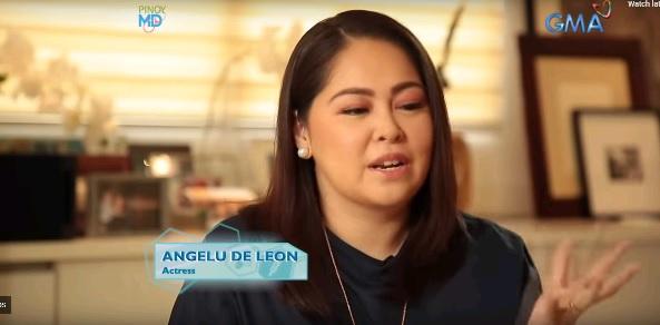 Angelu de Leon, ikinuwento ang pinagdaanan nang magkaroon ng Bell's Palsy | Balitambayan