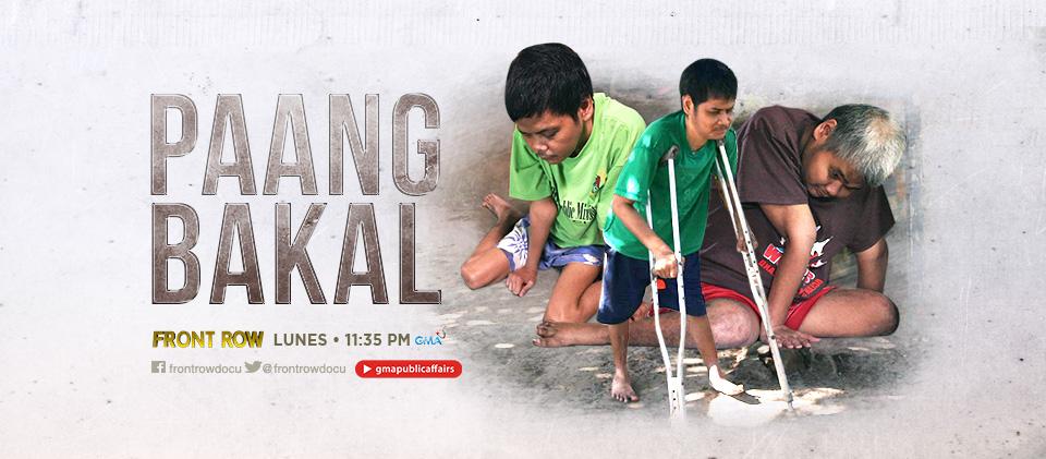 Tatlong magkakapatid na may polio, tampok sa ‘Front Row’ | GMA News Online