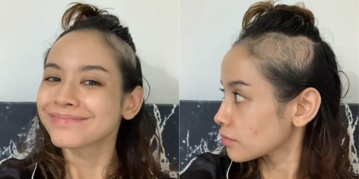 Bea Benedicto reveals she has alopecia: 'The bald spots just kept ...