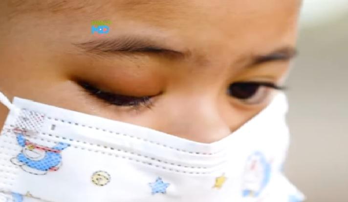Ano ang cancer sa mata na Retinoblastoma na madalas bata ang tinatamaan ...