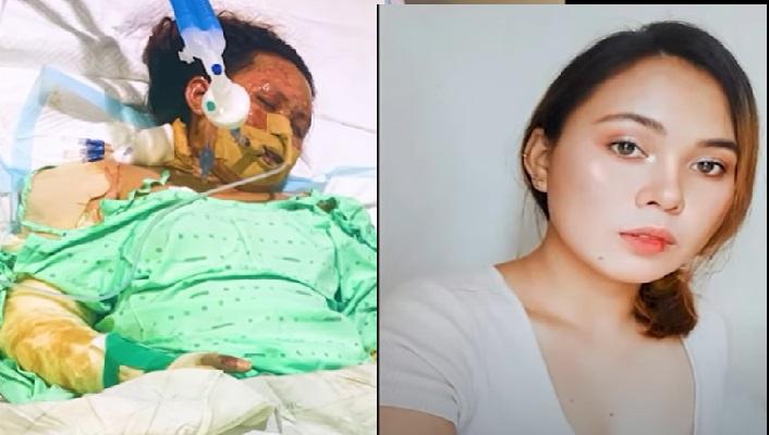 Babae, nalapnos ang halos buong katawan dahil sa 'sumabog' na tangke ng LPG | Balitambayan