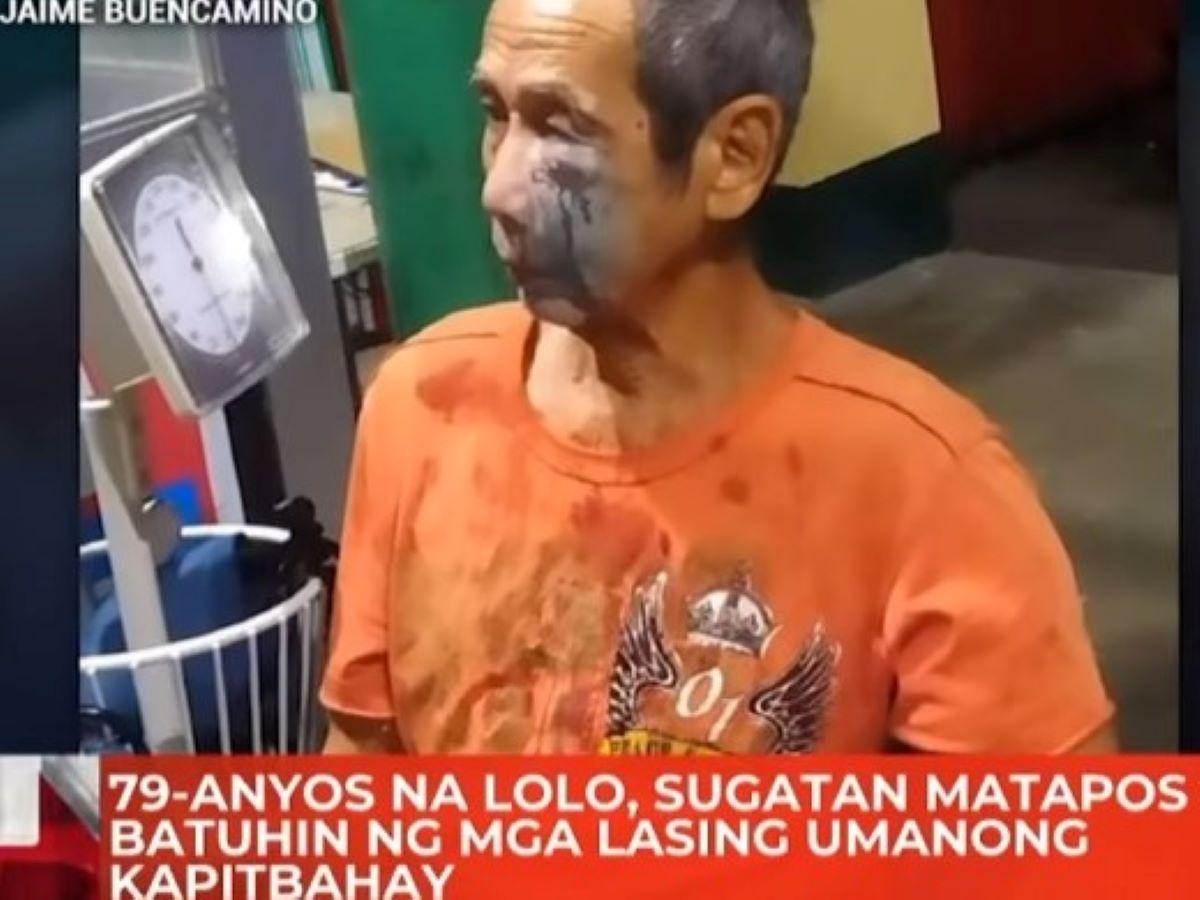 79-anyos na lolo, binato ng lasing na mga kapitbahay, namaga ang mukha ...