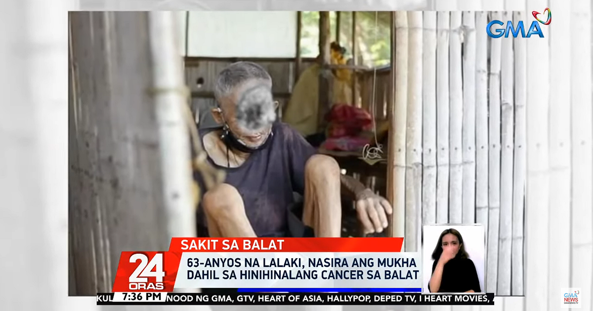 63-year-old man looks nearly unrecognizable with possible skin cancer ...
