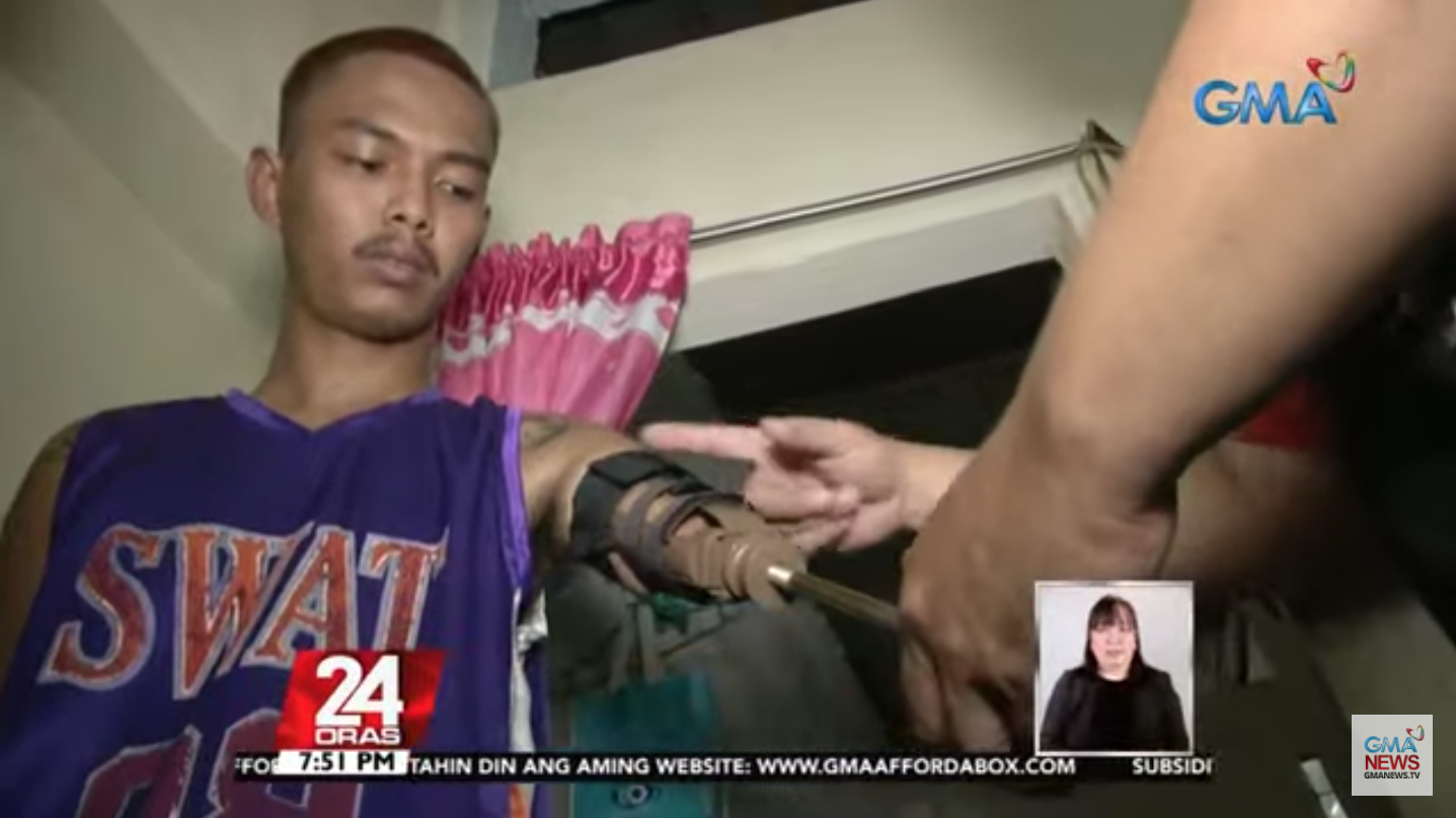 Man who lost arm after motorcycle accident gets prosthetic limb from ...