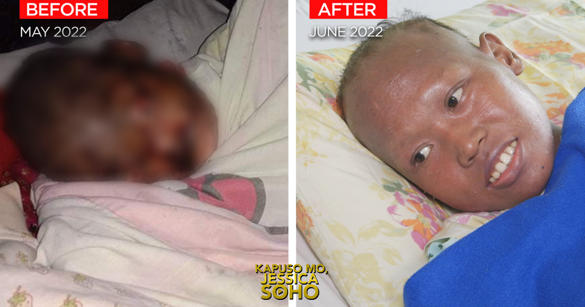 3 weeks after his story aired on KMJS, how is the 14-year-old boy from ...