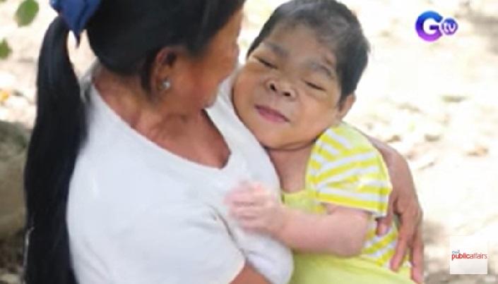 32-anyos na babae, tila nakulong sa katawan ng 3-taong-gulang na bata dahil sa kaniyang ...