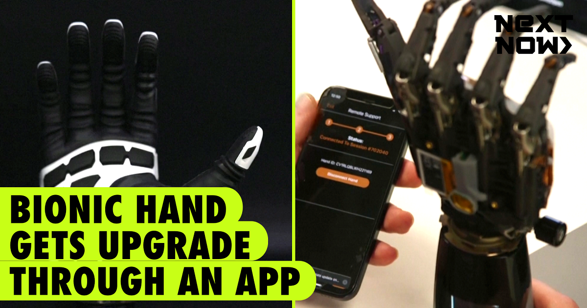 Prosthetics company develops bionic hand that can be adjusted using an ...