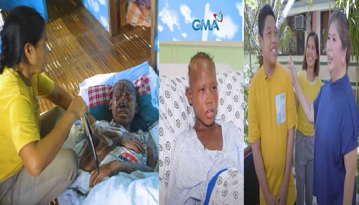 Lalaking tadtad noon ng mga sugat mula ulo hanggang paa, malusog at ...