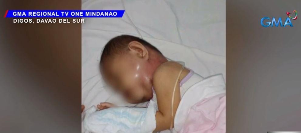 Baby dies from bite of centipede seen crawling out of bed | GMA News Online