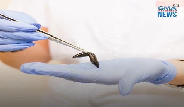 Buhay na linta, nakuha sa lalamunan ng isang babae na uminom ng tubig ...