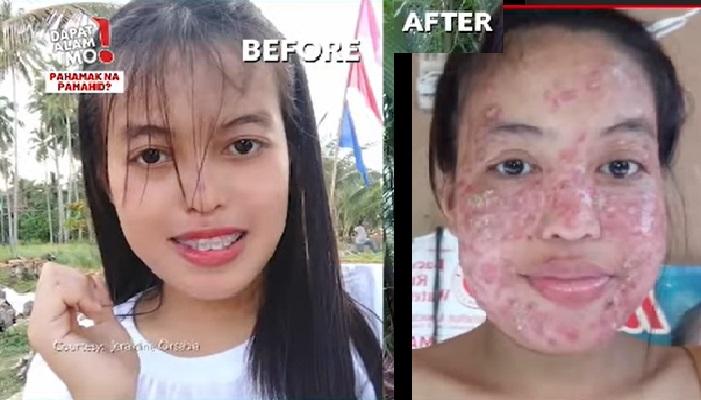 Mukha ng babae, natadtad ng taghiyawat dahil umano sa ipinahatid na ... Mukha ng babae, natadtad ng taghiyawat dahil umano sa ipinahatid na ...