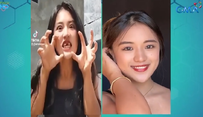 Bungi na Tiktokerist na si ‘Vampire Queen,’ gamitin kaya ang 'bago' niyang ngipin | Balitambayan