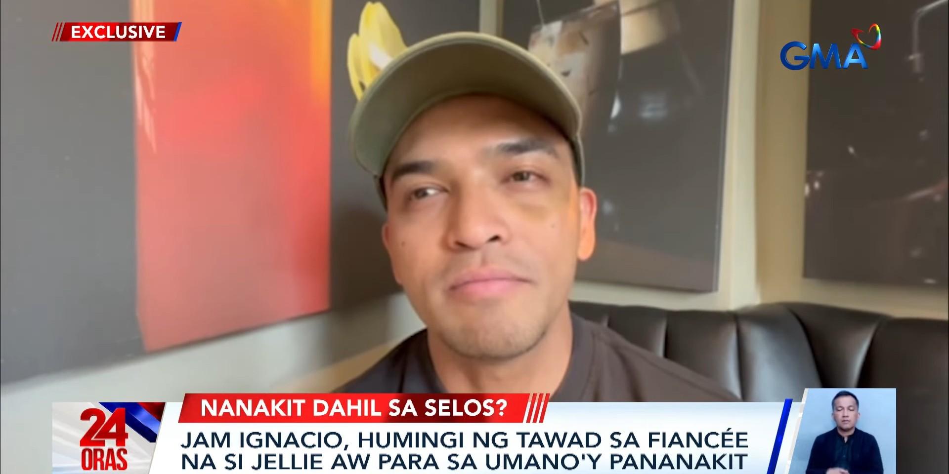 Jam Ignacio apologizes to fiancée Jellie Aw after she accused him of assault | GMA News Online