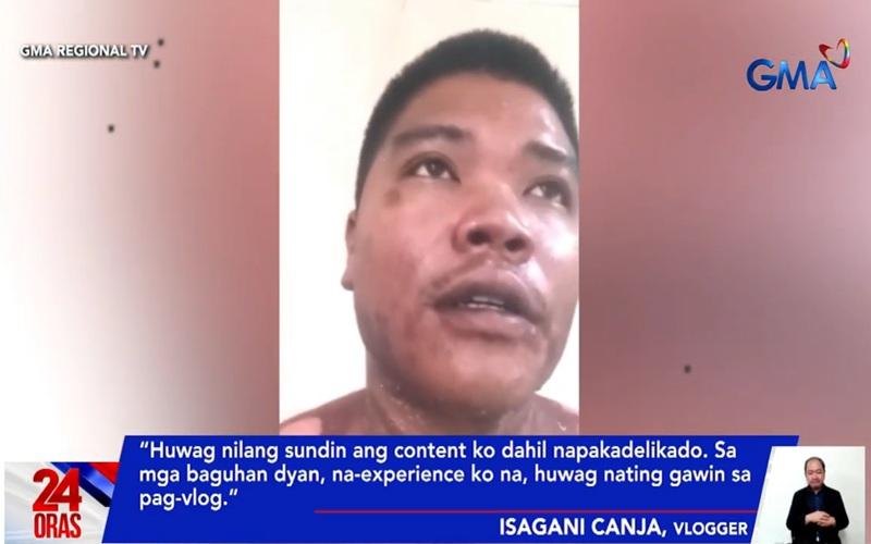 Vlogger na uminom, nagbuhos ng gasolina at sinilaban ang sarili, nagtamo ng mga paso sa katawan ...