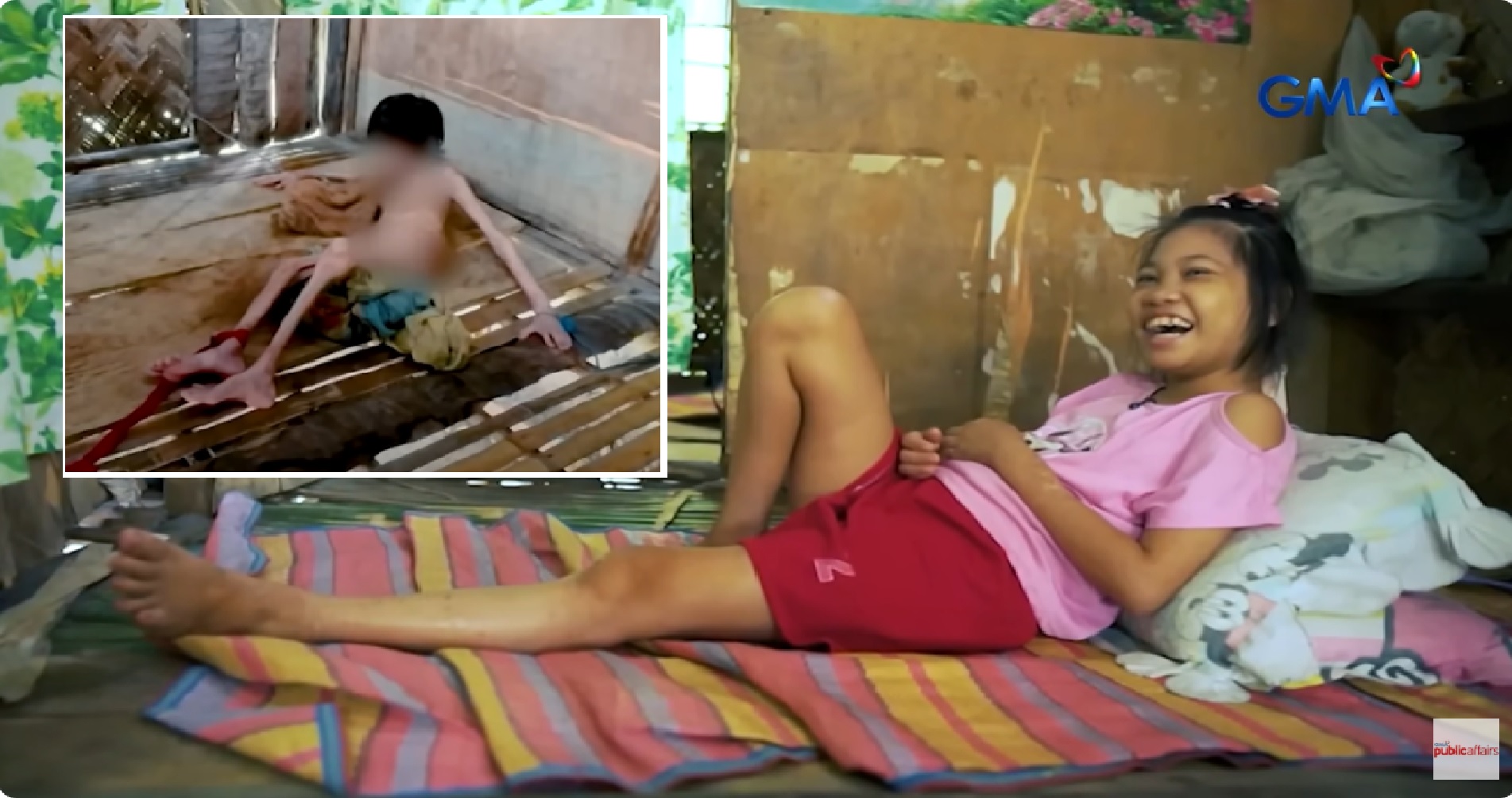 Buto’t balat na dalagita noon, mabuti na ang kalagayan matapos maitampok sa ‘KMJS’ | Balitambayan